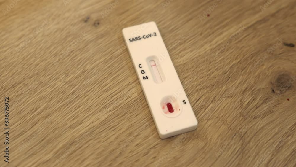Review of a negative covid 19 blood test. Sars-cov-2 negative. Fast diy ...