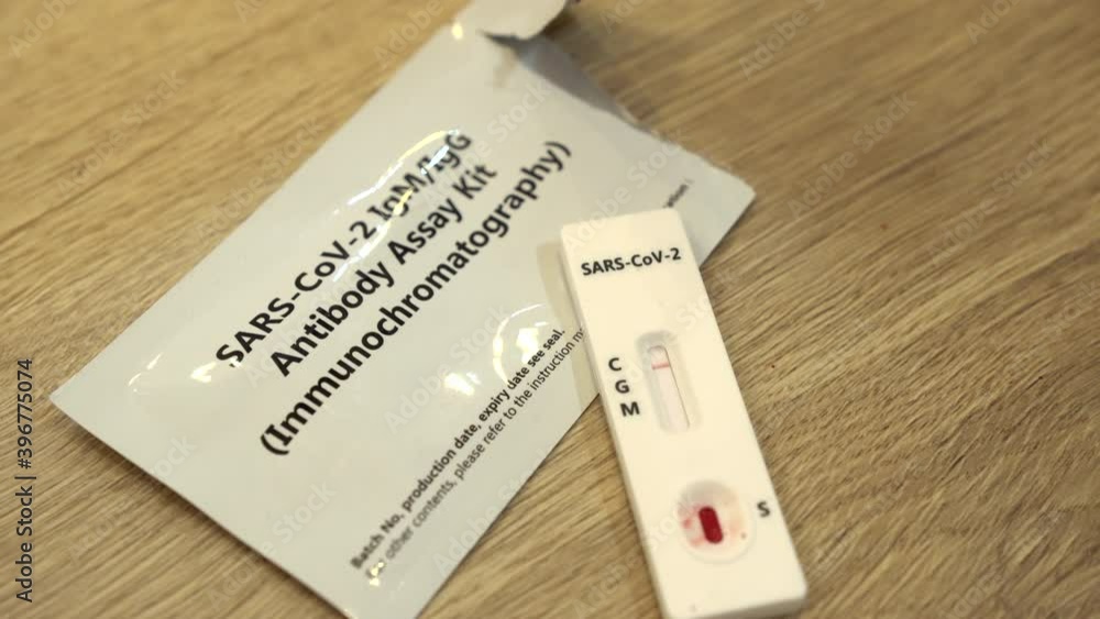 Review of a negative covid 19 blood test. Sars-cov-2 negative on top of ...