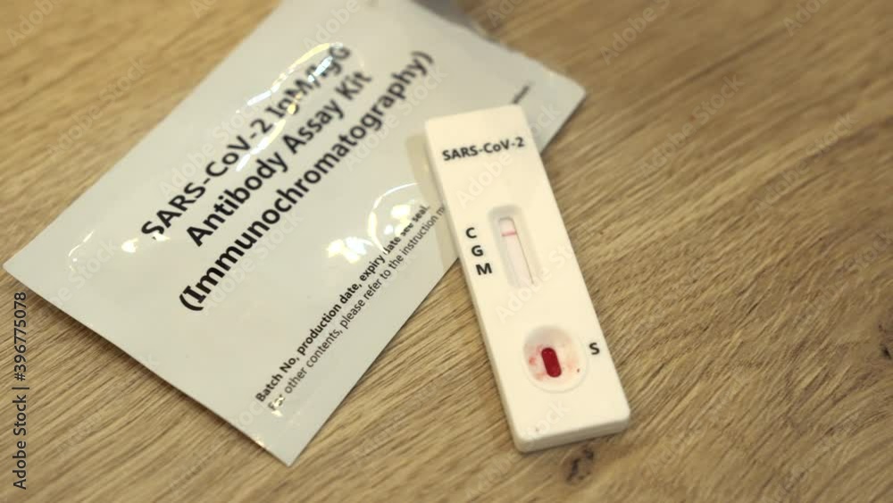 Review of a negative covid 19 blood test. Sars-cov-2 negative on top of ...