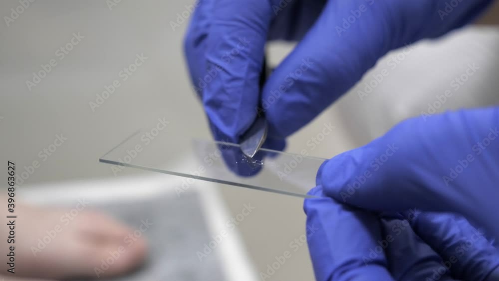 Analysis of the problem nail scraping of the female nail for further ...