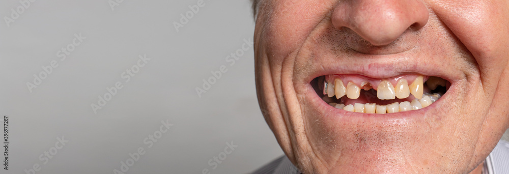 The toothless smile of an old European man on a gray background ...