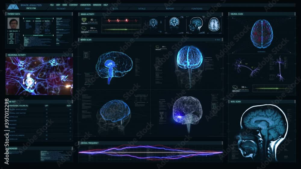 Futuristic technological interface analyzing human brain anatomy and ...