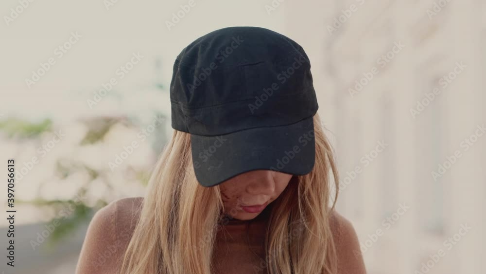 Home violence victim. Young woman portrait with scar on her face ...