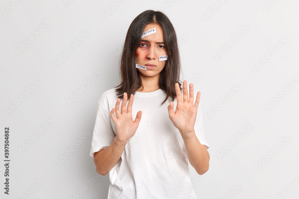 Foto de Sad brunette woman has bruised skin keeps palms towards camera ...