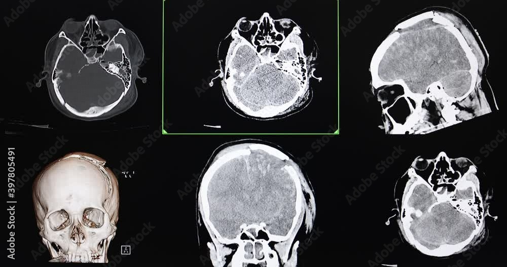 Multi screens CT cine scan of a patient with falling injury showing ...