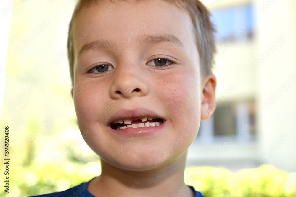 Little boy smiling without one tooth. Portrait of a laughing toothless ...
