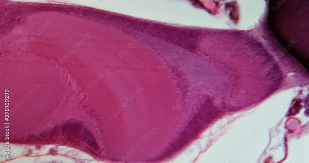 Complex eye of the honey bee with optic nerves under the microscope ...