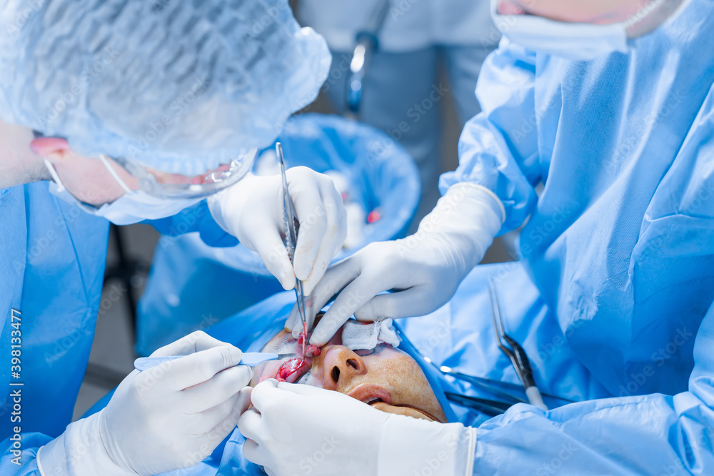 Blepharoplasty plastic surgery operation for modifying the eye region ...