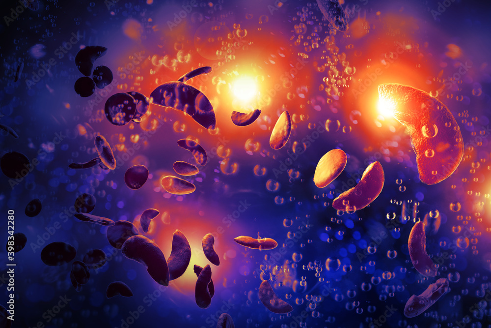 Sickle Cell Anemia 3D Illustration Stock Illustration | Adobe Stock