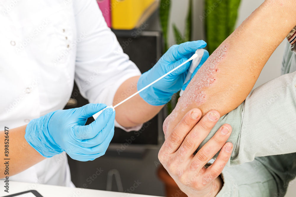 A dermatologist takes a skin analysis of a sick patient. Examination ...