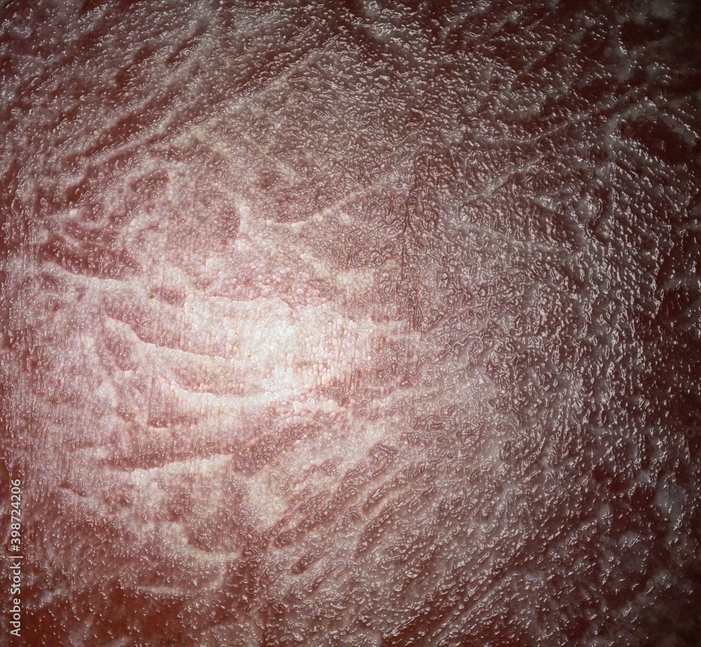 Dark Messy Dust Overlay Distress Background Abstract Dotted Scratched ...