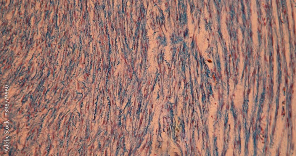 Umbilical cord in cross section under the microscope 100x Stock ビデオ ...