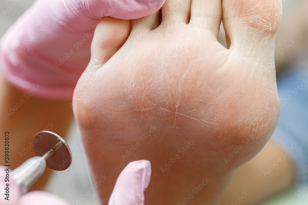 Women's feet and pedicure master. Professional hardware pedicure in a ...