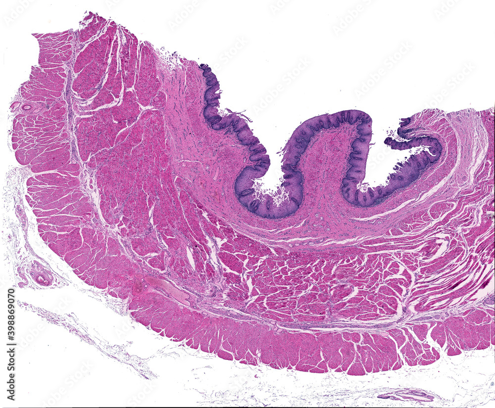 Layers of the esophagus foto de Stock | Adobe Stock
