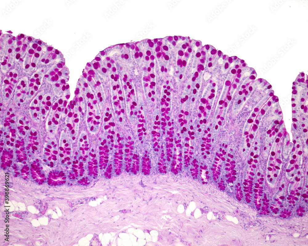 Colon mucosa. Goblet cells Stock Photo | Adobe Stock