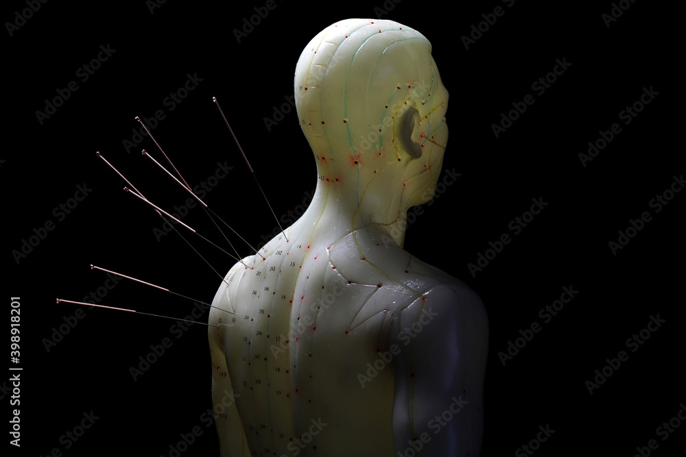 male acupuncture model with needles in the left shoulder against black ...