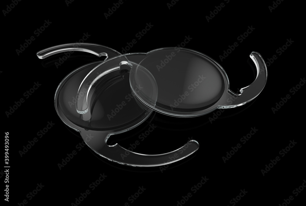 iol intraocular lens cataract ophthalmology Stock Illustration | Adobe ...