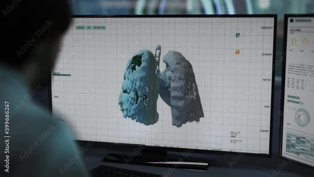 A doctor is researching internal organ damages. Using computerized ...