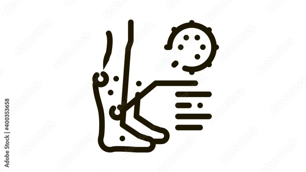 rash dermatitis on legs Icon Animation. black rash dermatitis on legs ...