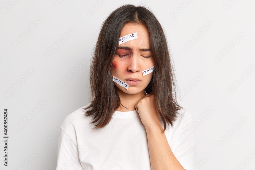 Frustrated young beaten woman with big bruise closes eye has fear of ...