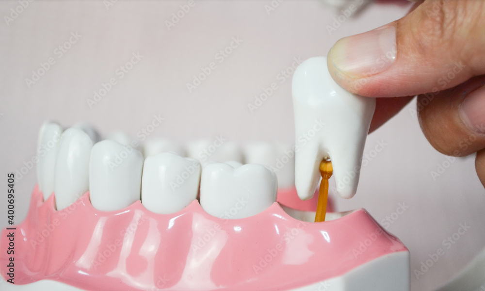 Hand extracting a tooth model,Hand pulling out a tooth model.Hand ...