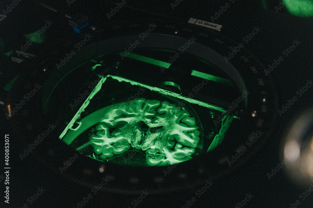 Human brain slide in illuminated microscope at laboratory Stock Photo ...