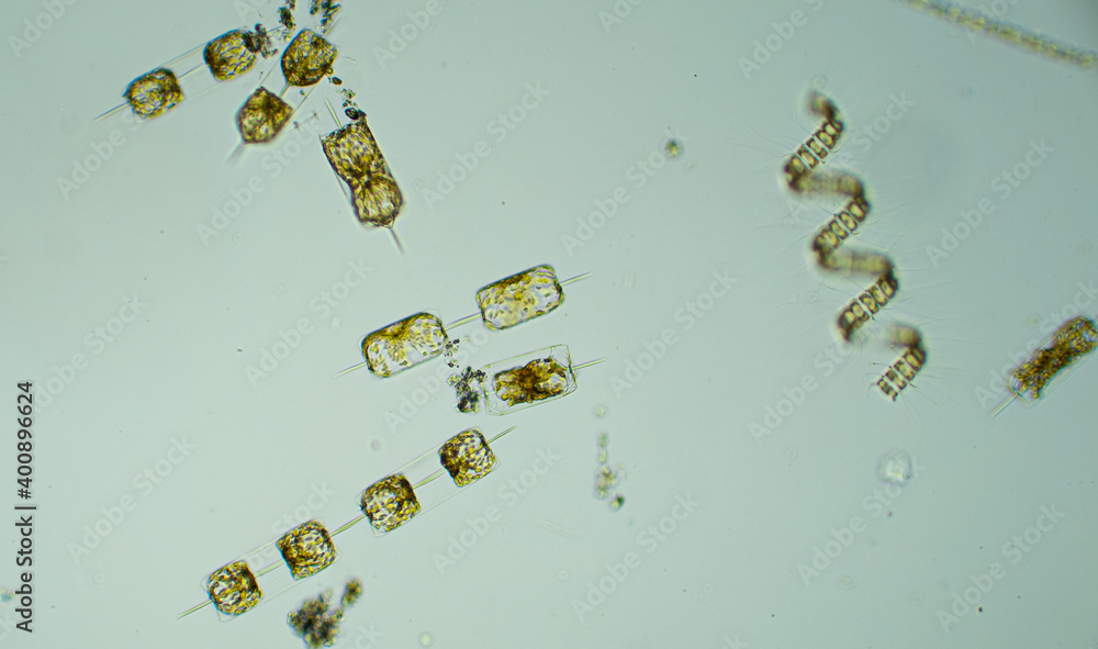 Marine Phytoplankton: Ditylum and Chaetoceros spp. Stock Photo | Adobe ...