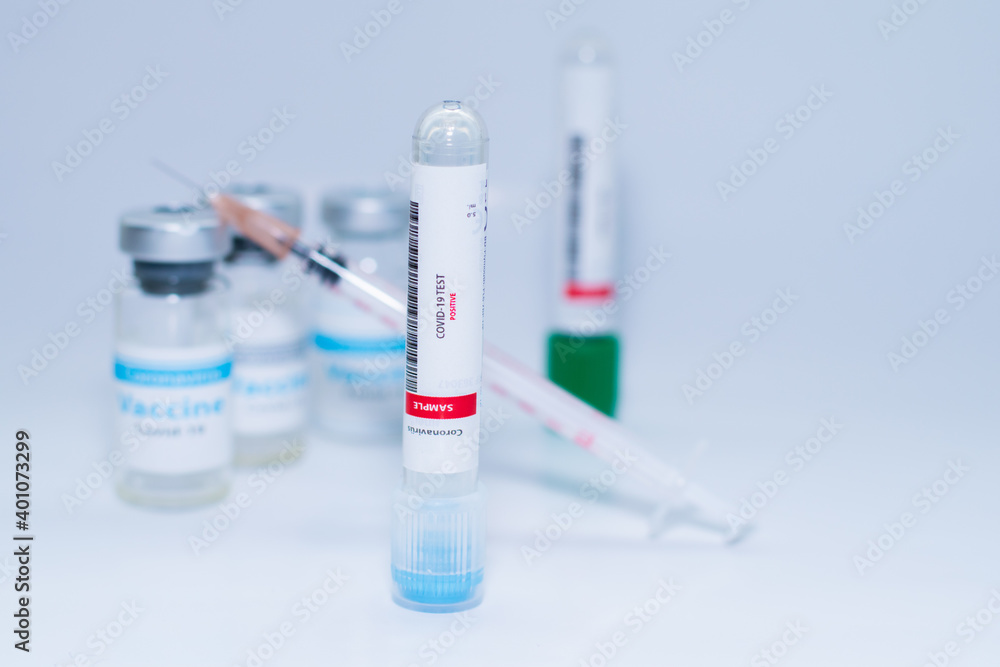 Testing for presence of coronavirus. Tube containing a swab sample that ...