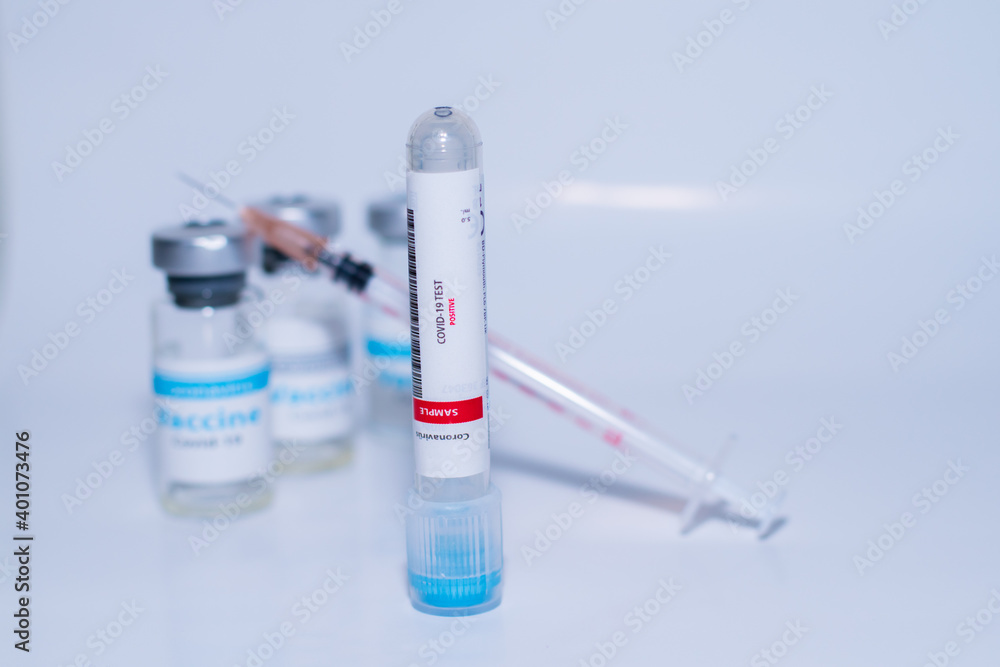 Testing for presence of coronavirus. Tube containing a swab sample that ...