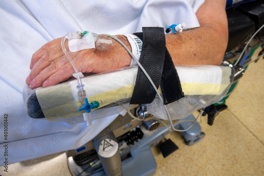 in a hand of an operated patient is venous cannula for infusion Stock ...