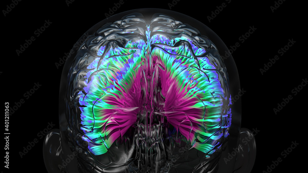 Human brain, neurones connections. Colorful brain MRI scan Stock ...