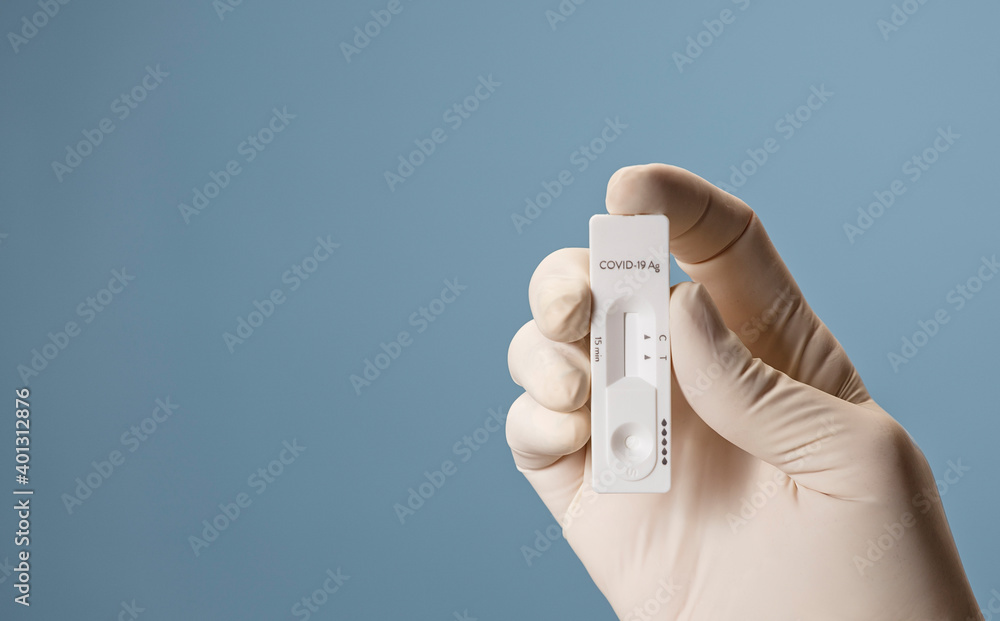Rapid COVID-19 test. Serological detection of IgM and IgG antibodies ...