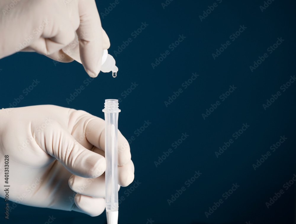 Doctor containing a COVID-19 2019-nCoV viral disease test kit. SARS-CoV ...