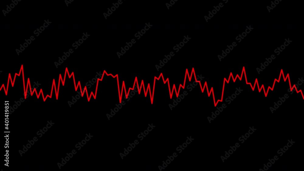Electrocardiogram is a medical examination to see the electrical ...