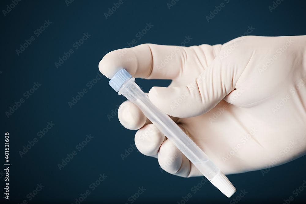Doctor holding a test vial for viral disease testing with the COVID-19 ...