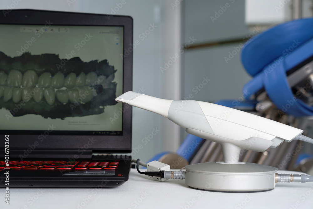 dental scanner for intraoral scanning and laptop for software ...