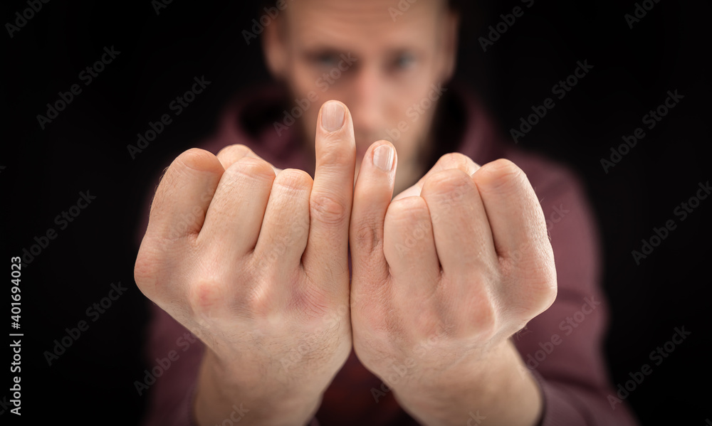 Hands of disabled man with different long pinkie finger shown into the ...