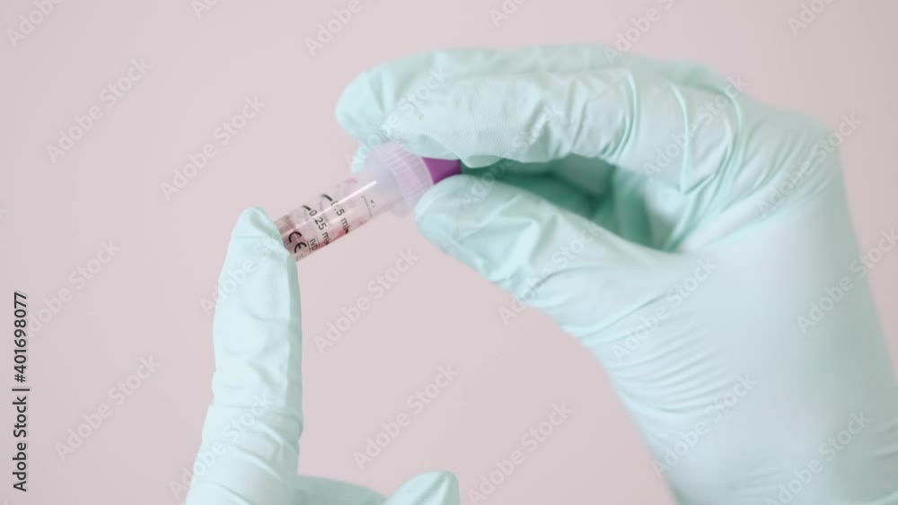 Blood testing, plr test, coronavirus concept. The nurse is looking at ...