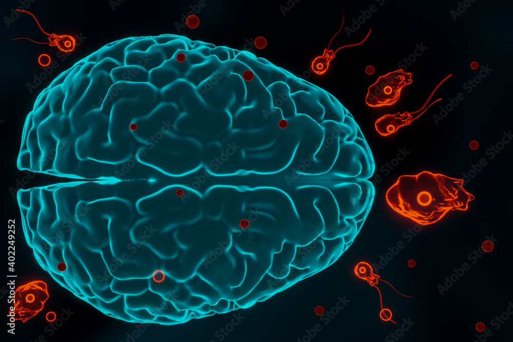 Brain-eating amoeba infection, naegleriasis. Flagellate forms ...