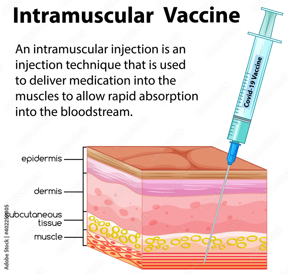 Information vector on intramuscular injection Stock Vector | Adobe Stock