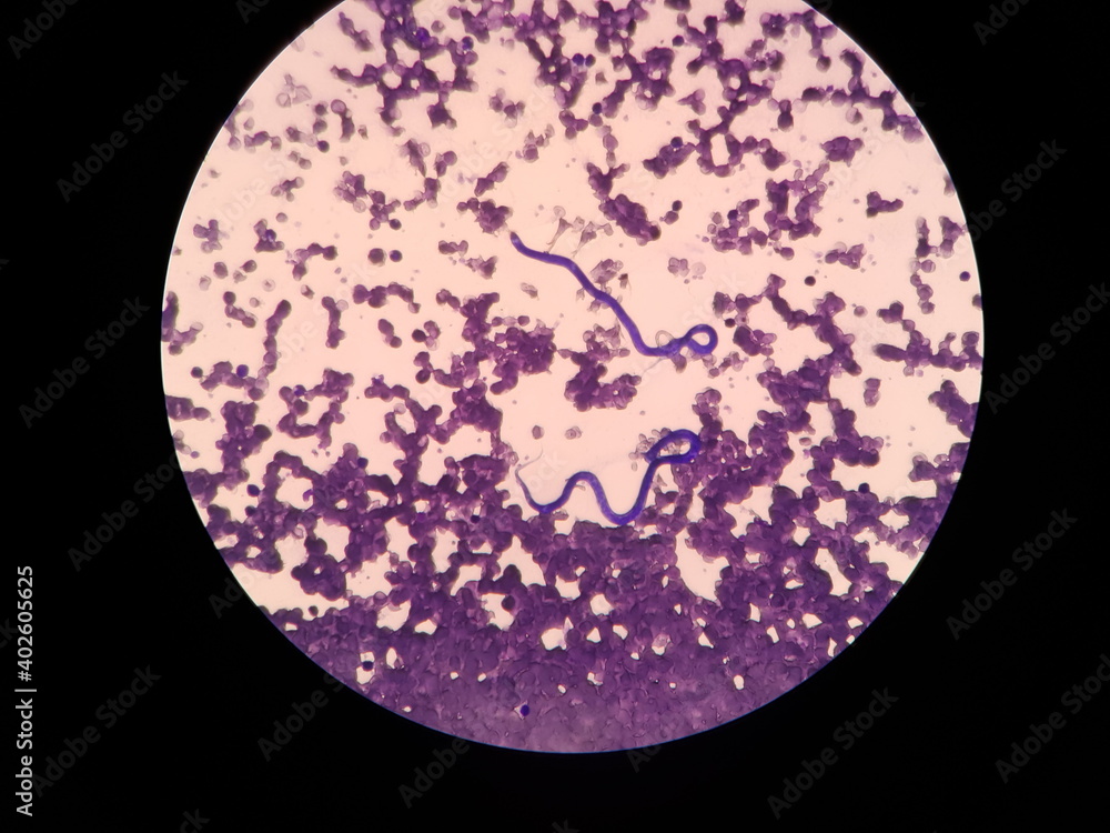 Microfilariae are not sheathed in the blood smear of a dog. Light ...