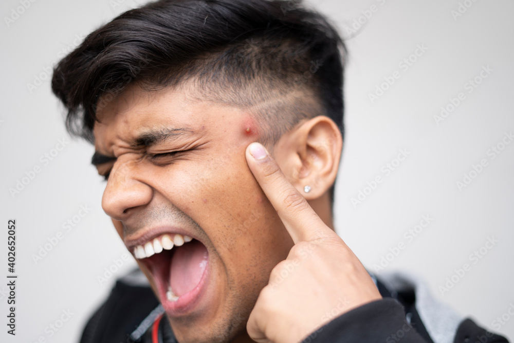 portrait of a young man is use to touch pimples on the face standing on ...