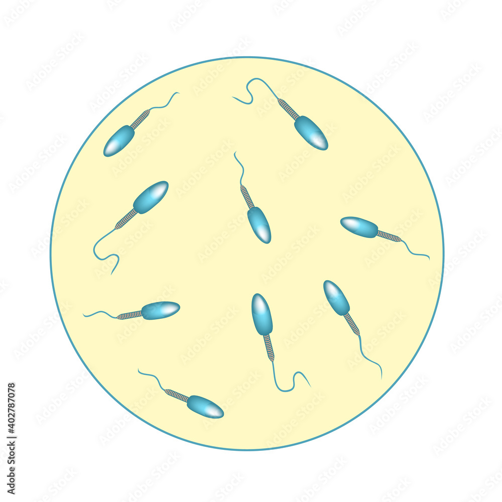 Low sperm count in seminal fluid. Low abundance of sperm in the ...
