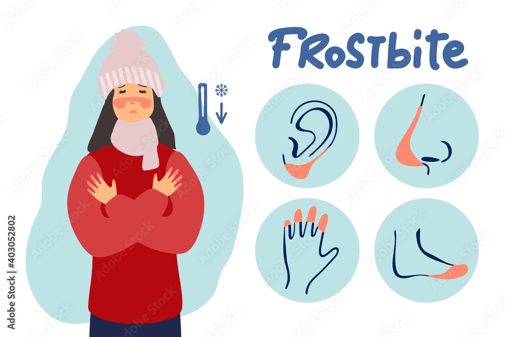 woman froze. Frostbite concept banner. Cartoon illustration of ...