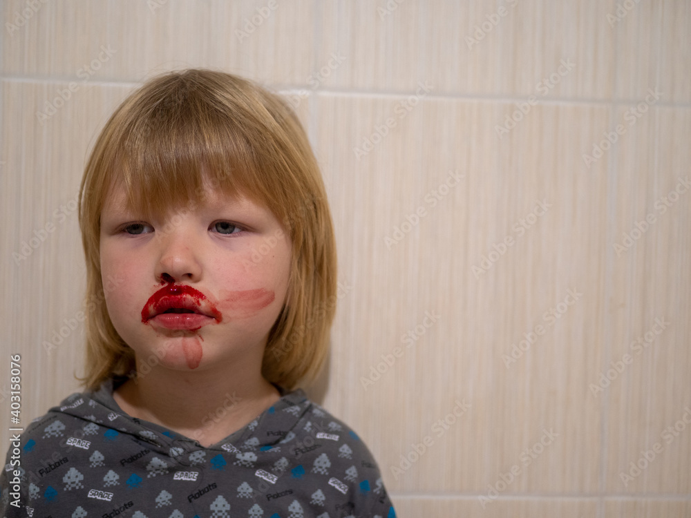 little fair-haired boy is smeared with blood. baby has weak vessels in ...