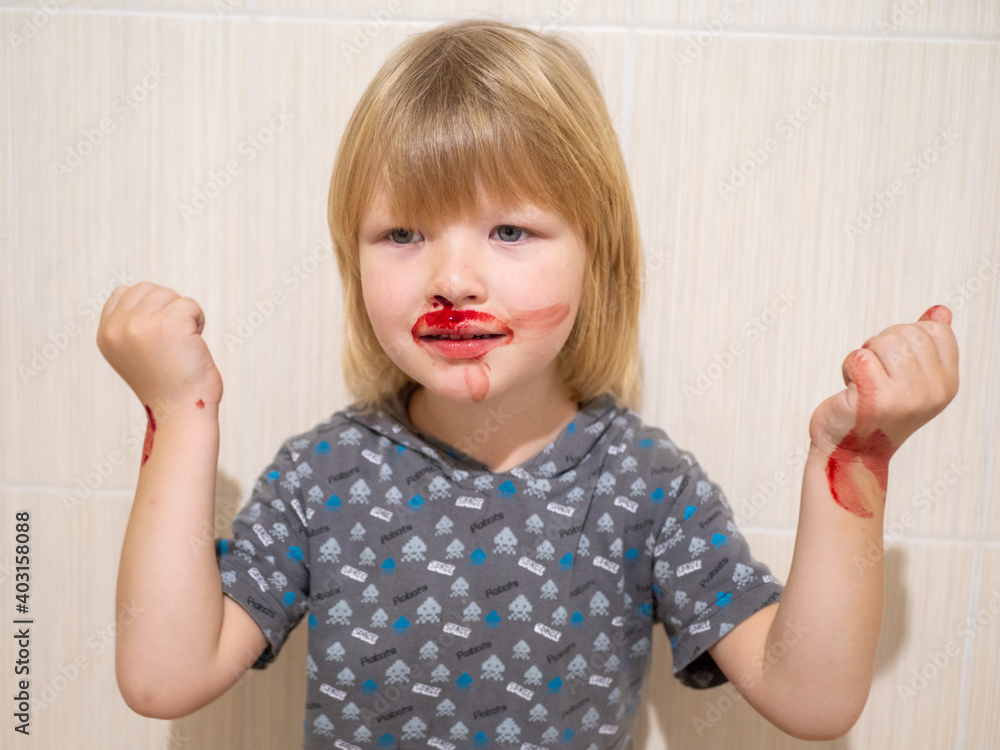 little fair-haired boy is smeared with blood. baby has weak vessels in ...