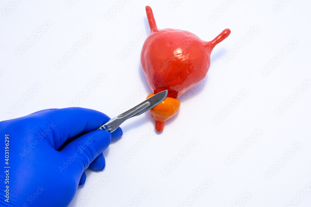 Doctor urologist surgeon holds a scalpel in his hand over the ...