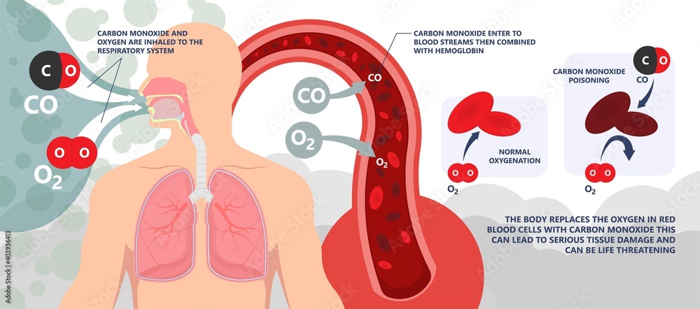 CO level chest pain loss of consciousness gas death cherry red skin ...