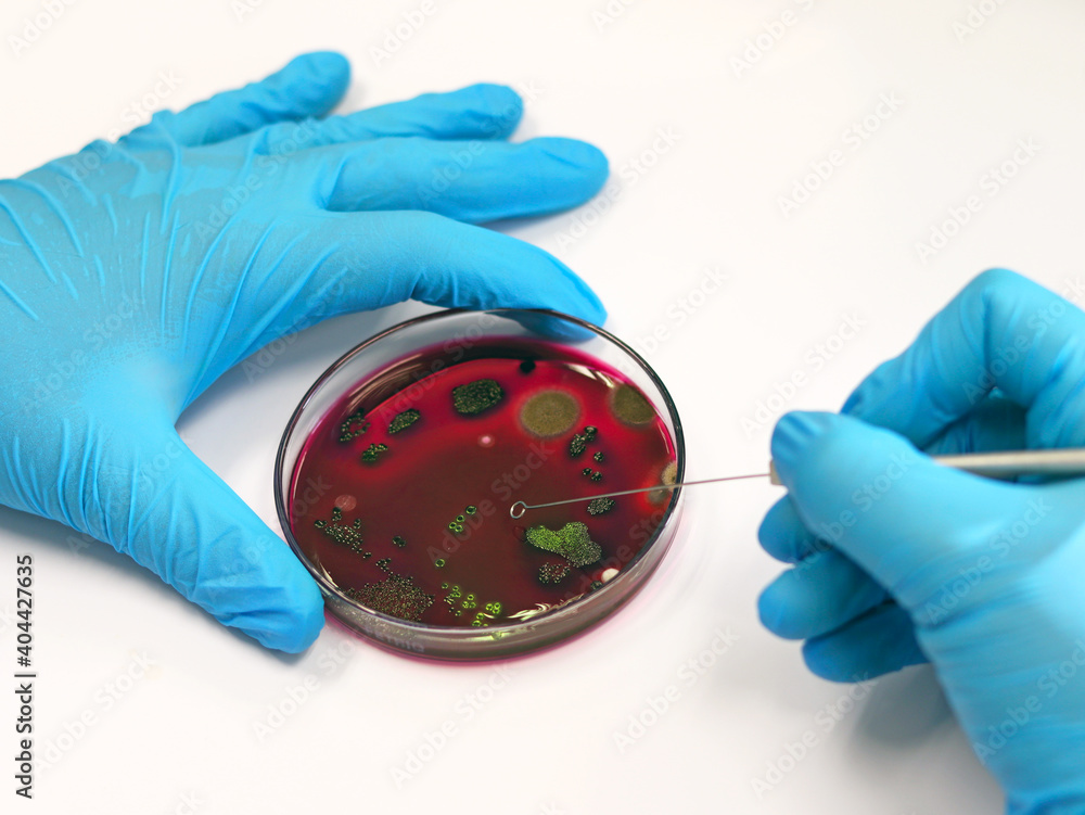 Foto de Scientist analysis Escherichia coli (E.coli) culture with Eosin ...