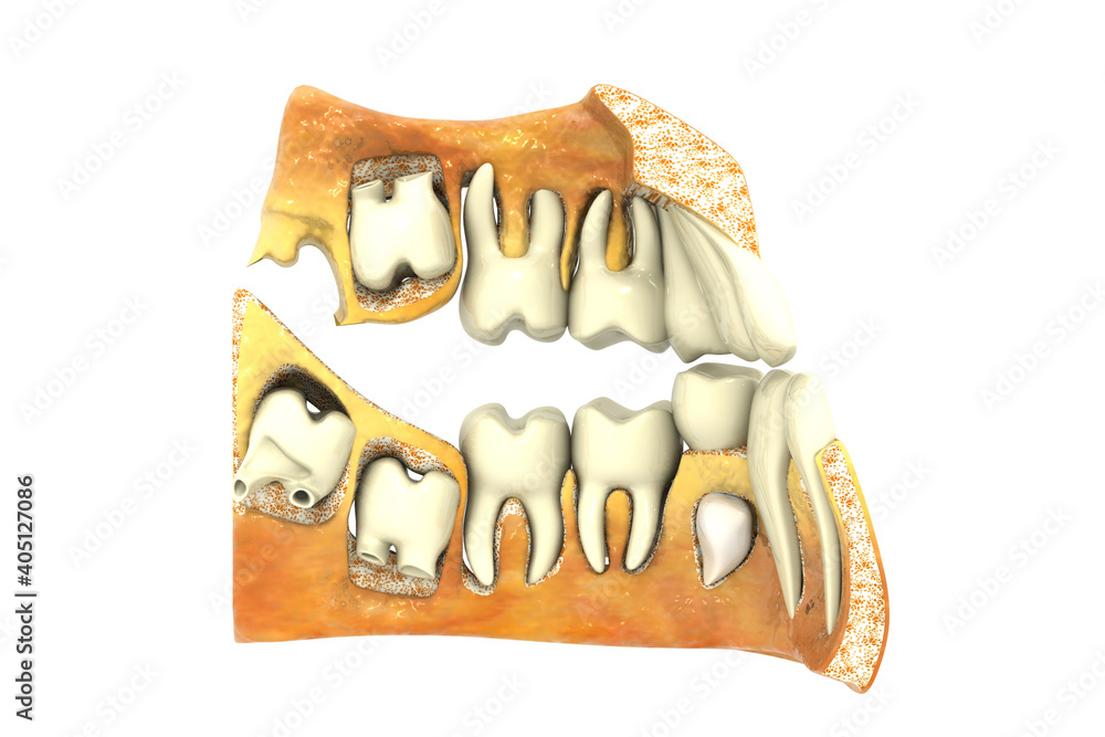Anatomy of Maxilla and Mandible Stock Illustration | Adobe Stock
